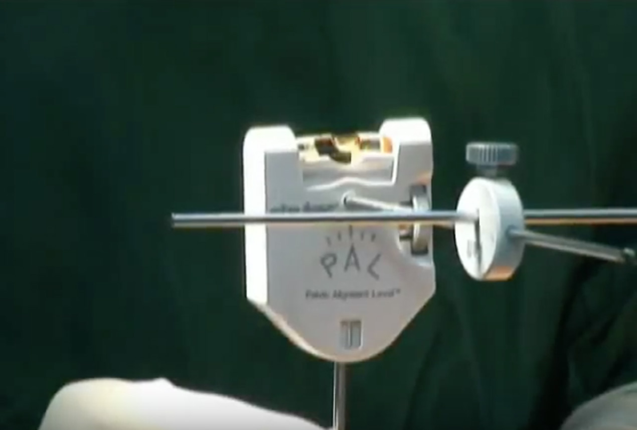 Pelvic Alignment Level (PAL) - The Leone Center for Orthopedic Care