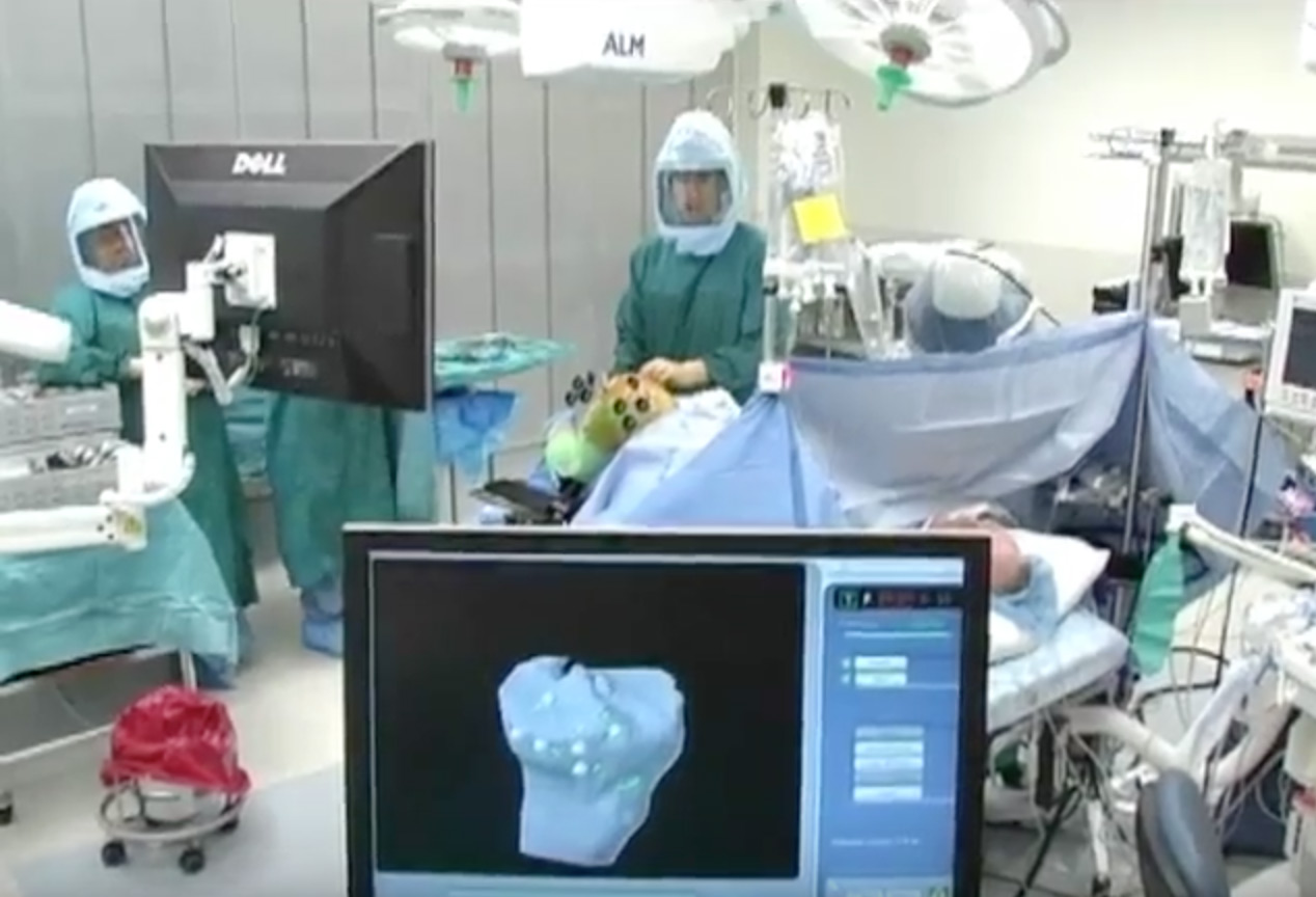 Mako Rio navigation tool - The Leone Center for Orthopedic Care