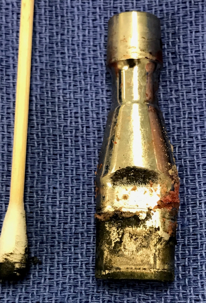 Painful total hip or total knee: Do I have an allergy to the metal ...